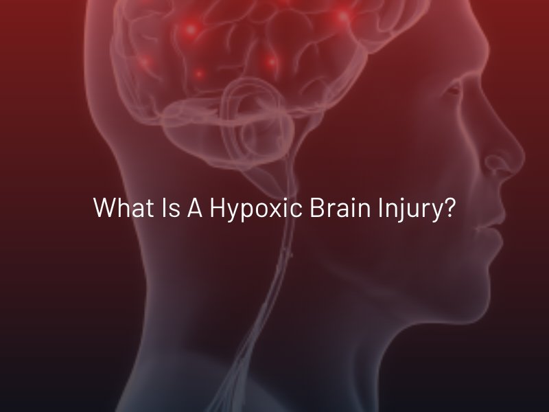 What Is A Hypoxic Brain Injury What Is A Hypoxic Brain Injury
